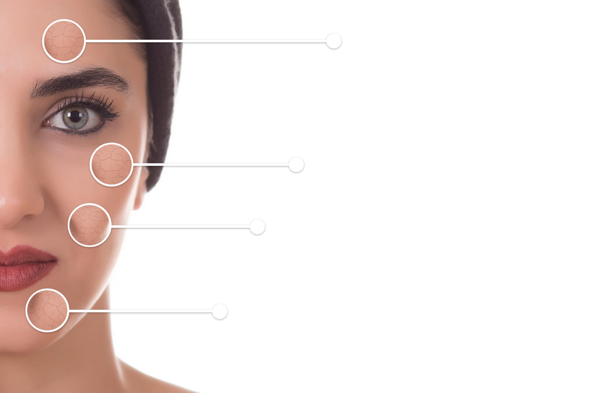 Dry skin on the face: Causes and ways of treatment