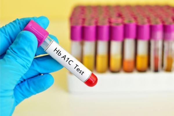 Γλυκοζυλιωμένη: φυσιολογικές τιμές και πώς πέφτει