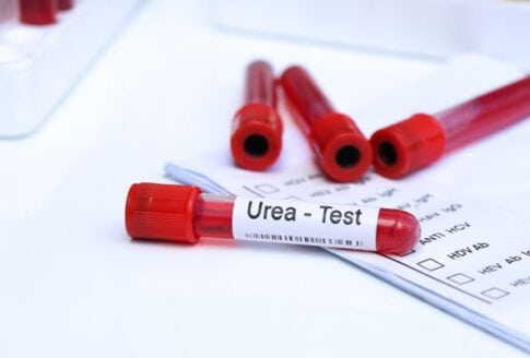 Ουρικό οξύ: Τι είναι, συμπτώματα & διατροφή