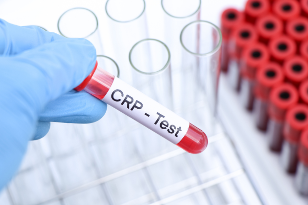 CRP: what is it & normal values